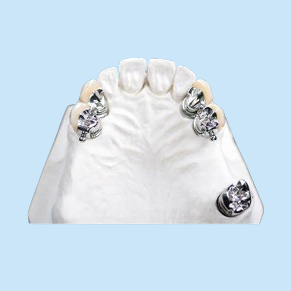 Easy Clean OEM Precision Attachment Partial Denture Stain Resistant