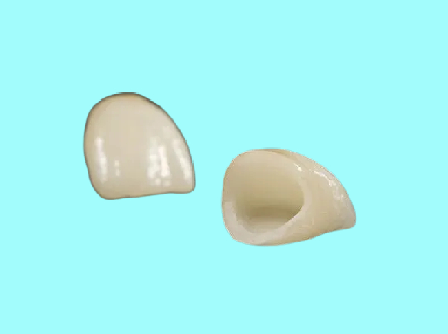 Highly Biocompatible Ceramic Dental Crown Realistic Beautiful Colors ...