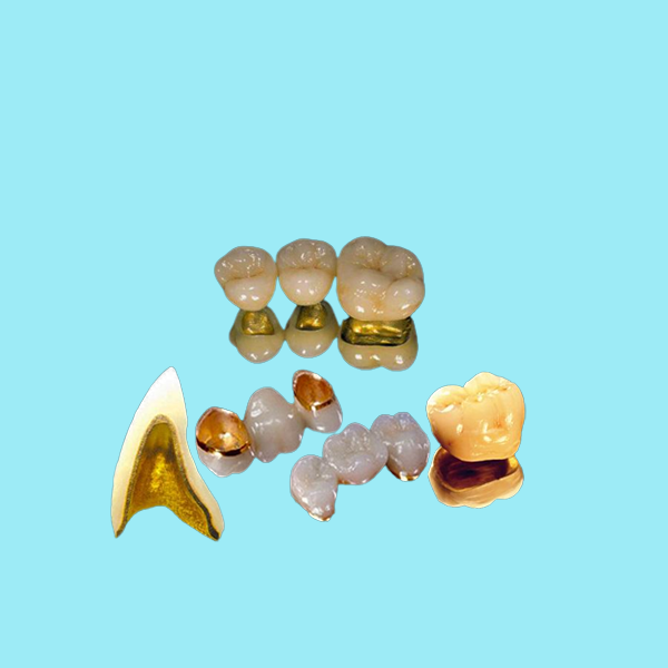 Color Stable PFM Full Crown High Strength Beautiful Appearance