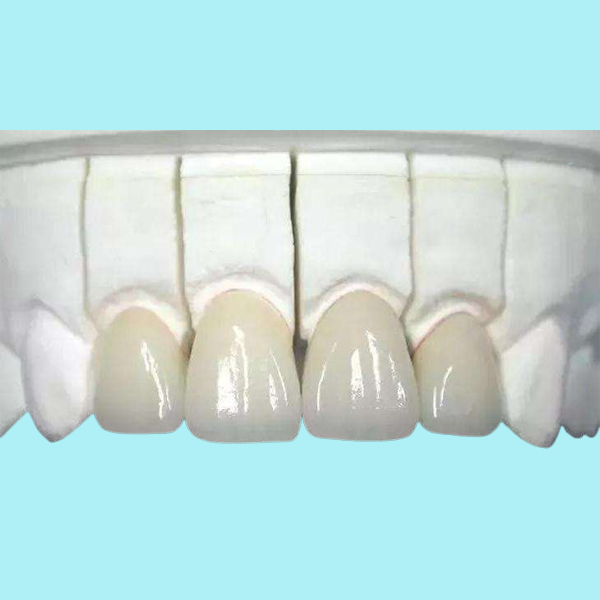 3D Printed Zirconia Dental Crown Wear Resistant Highly Biocompatible