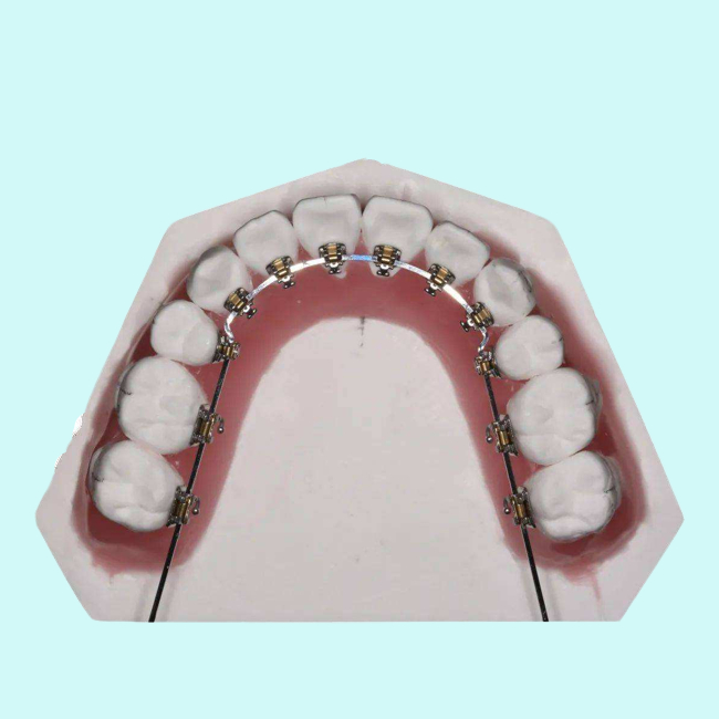 Straight Wire Fixed Orthodontic Appliances For Teeth Straightening
