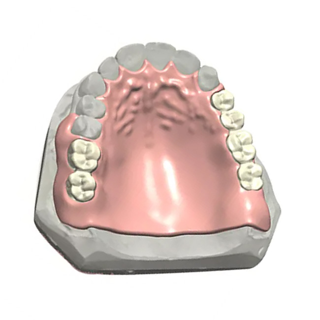 Removable Dental Partial Denture Natural Color 3D Dental Model Customized