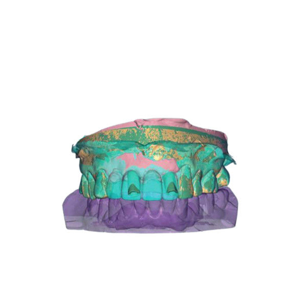 Precise CAD / CAM Complete Removable Dentures Removable Dental Crown