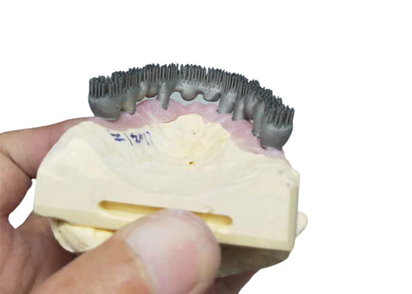 Durable CAD CAM PFM 3D Printer Dental Lab Prints For Research