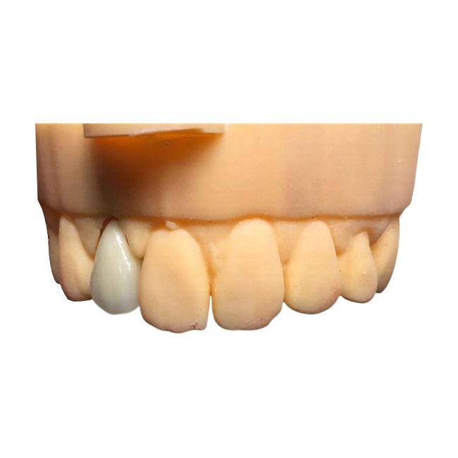 Chromecast Safety PFM Dental Crown Bridge Good Biocompatibility