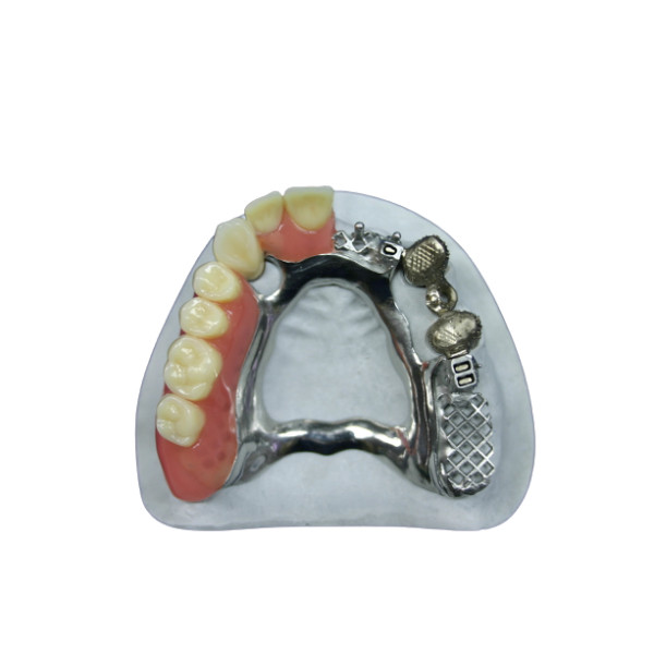 Beautiful Appearance Precision Attachment Denture Implant Attachments