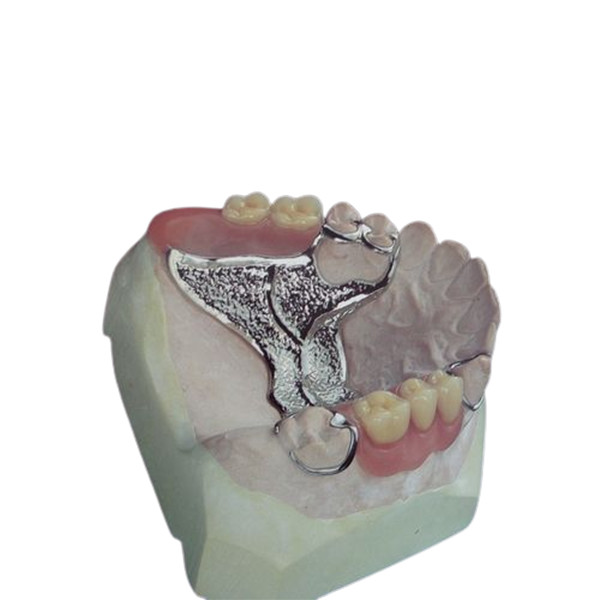 Custom OEM Cast Removable Partial Denture High Strength Digitization Design